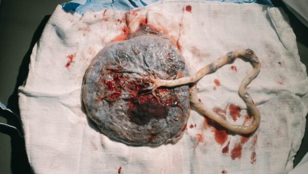 De nageboorte: laatste fase van de bevalling | Bevallen